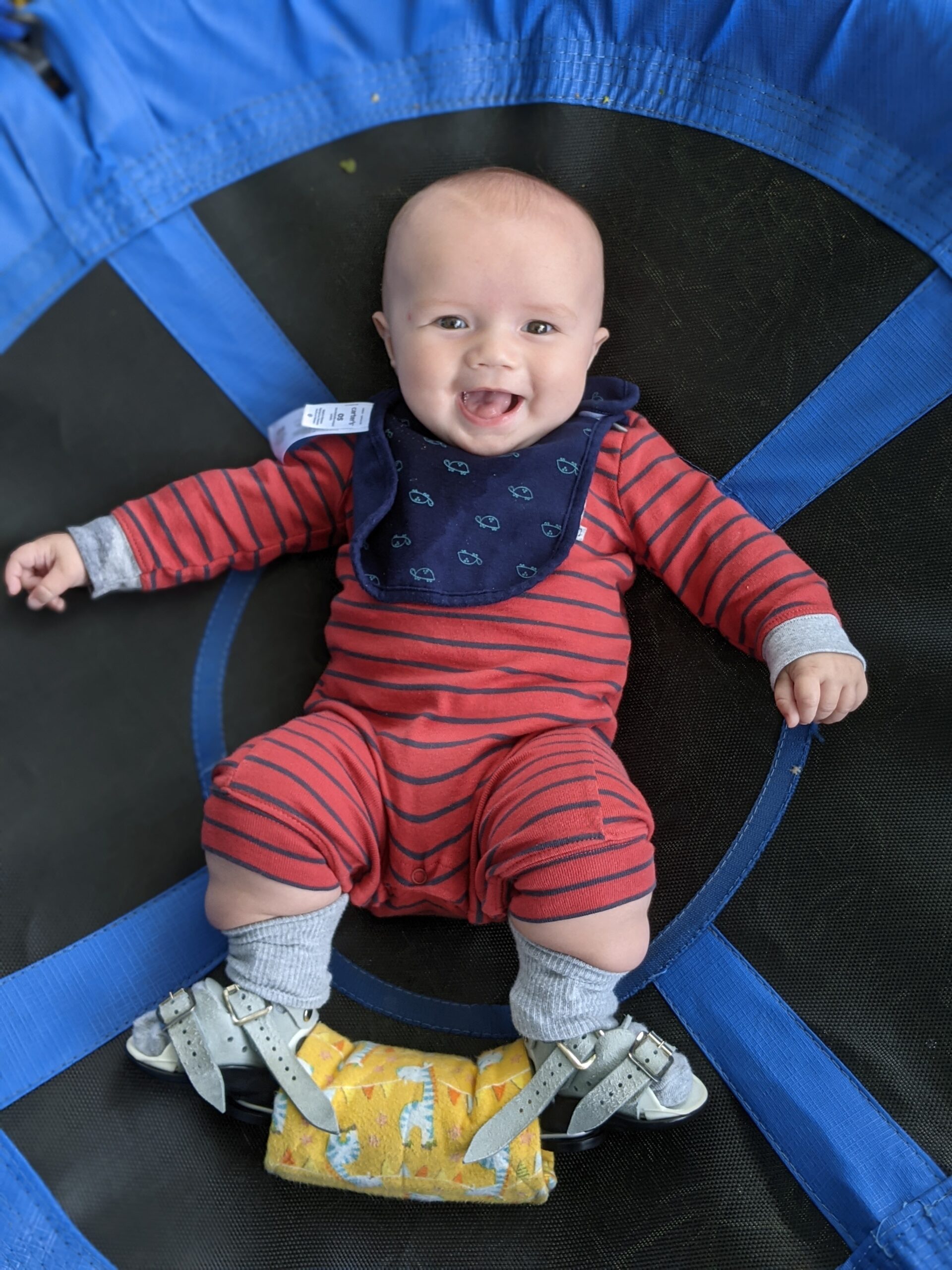 Clubfoot Journey: Introducing Owen from Ontario - Canadian Clubfoot ...